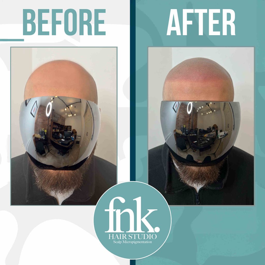 Hair Tattoo Before and After - FNK Hair Studio